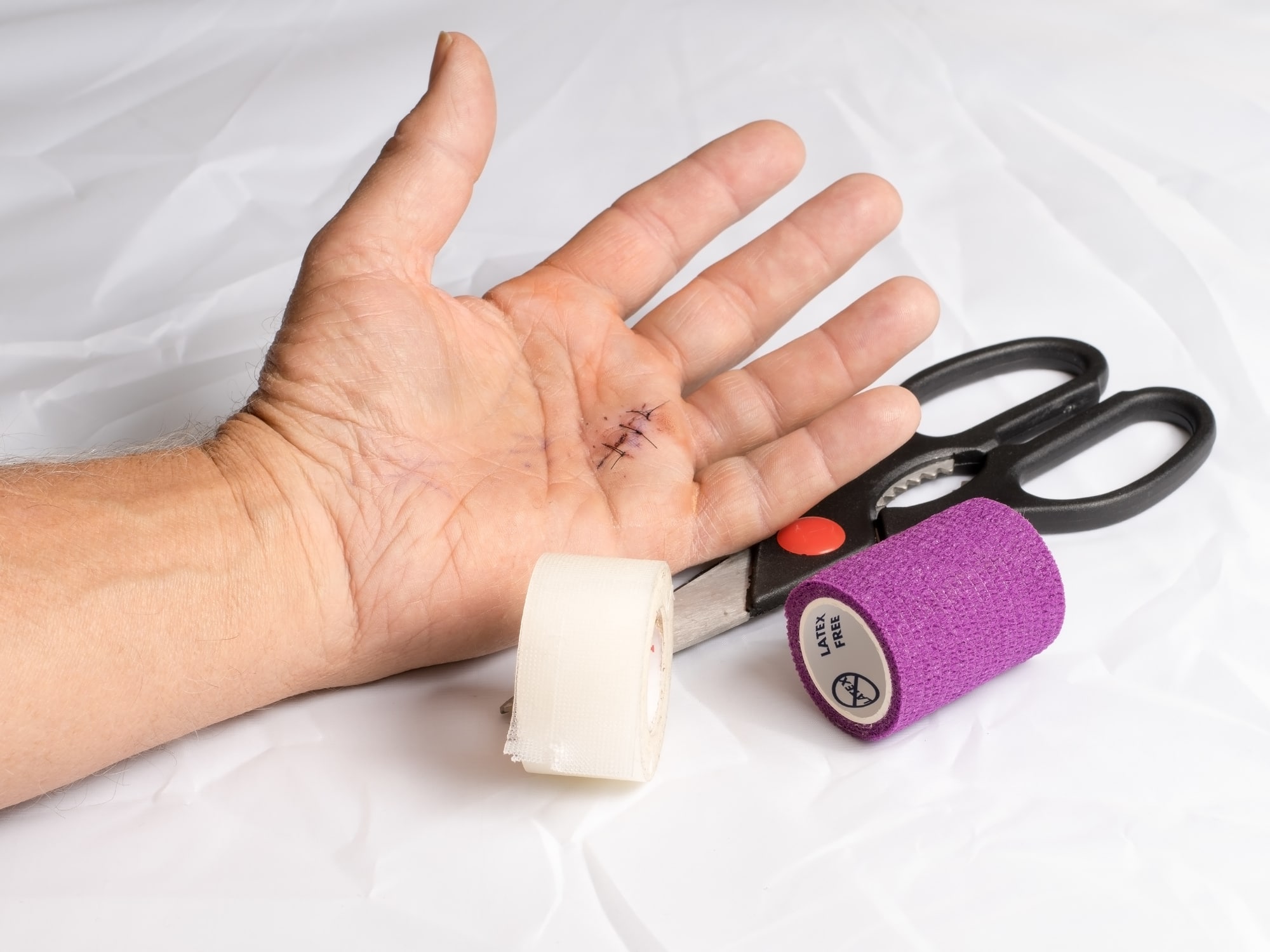 Gonna Need A Bigger Band-Aid: The Brief Guide on When to Get Stitches